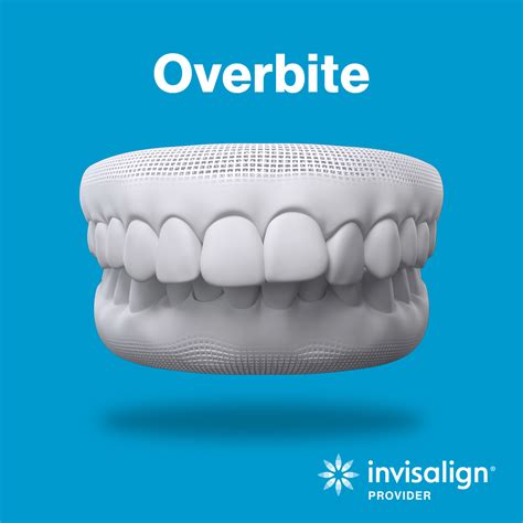 What Is A Overbite Happy Orthodontics