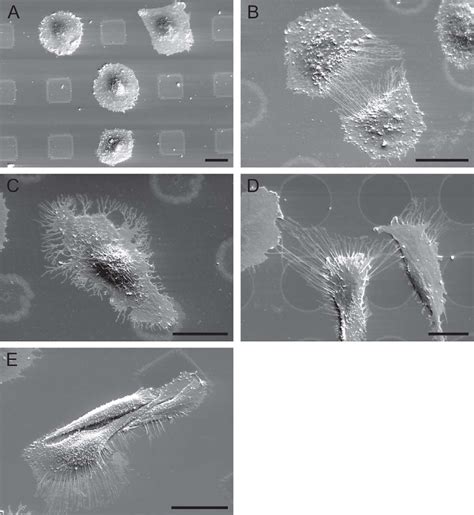 Cells Adhering To The Medium Sized Patterns No Longer Conformed Download Scientific Diagram
