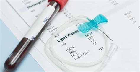Understand CPT Code For Lipid Panel 80061 The Medicators