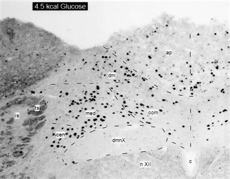 High Magnification Photomicrograph Of Fos Expression In Nts Subnuclei Download Scientific