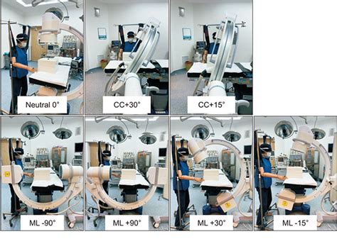 Radiation Exposure During Different Percutaneous Renal Puncture Techniques A Yau Endourology