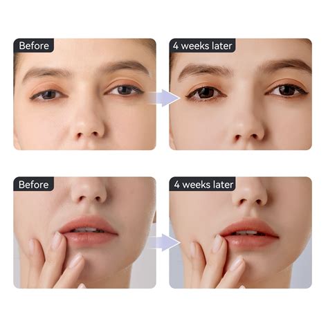 Anlan Ems Microcurrent Eye Beauty Device