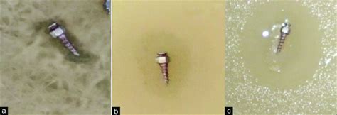 Disk Diffusion Tests Showing Zone Of Inhibition For A Streptococcus