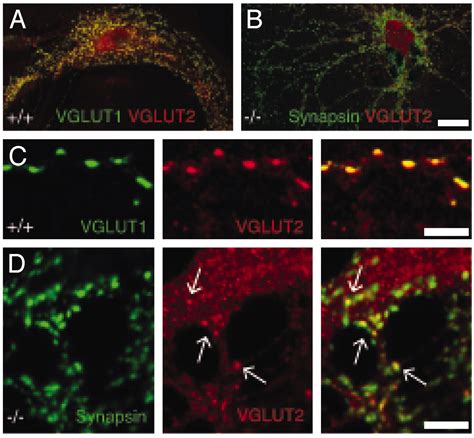 An Essential Role For Vesicular Glutamate Transporter 1 Vglut1 In Postnatal Development And