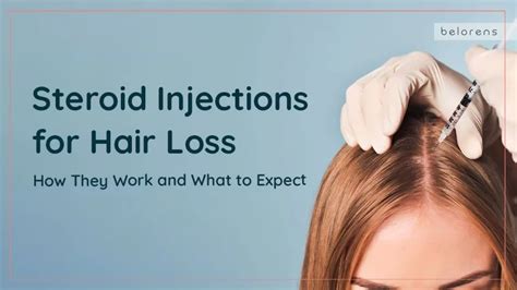 Steroid Injections For Hair Loss Does It Work Belorens