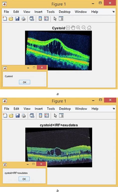 Cnn Output Results A Tested Output Result Sample 1 B Tested Download Scientific Diagram