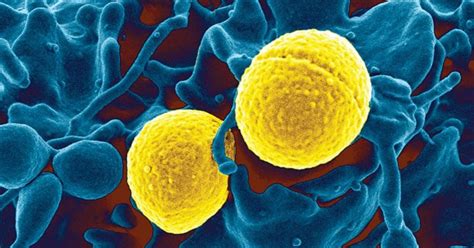 Real Time Surveillance Sequencing Shows Promise For Hospital Outbreak