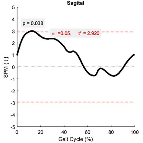 Statistical Parametric Mapping SPM Compared Knee Kinematics Between