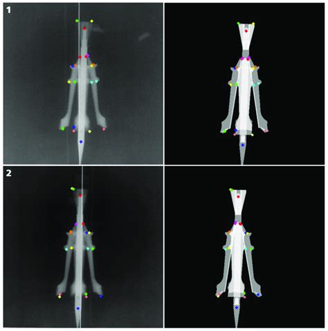 Example Of The Software Based X Ray Analysis On The Left Side The