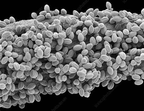 Willow Pollen Sem Stock Image F0439923 Science Photo Library