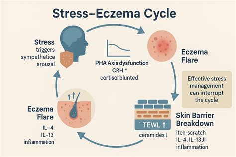 Dyshidrotic Eczema Triggers Bragan Skincare