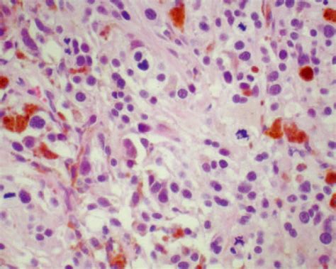 FELINE DIFFUSE IRIDAL MELANOMA Vet Times