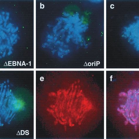 Chromosome Tethering Of Ebv Plasmids Depends On Ebna 1 Gene And Orip