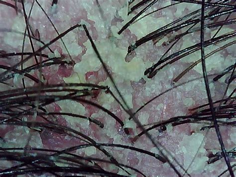 Before After Gallery Revival Scalp Studio