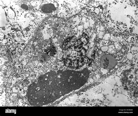 A Transmission Electron Micrograph Of The Ebola Virus In A Specimen Of