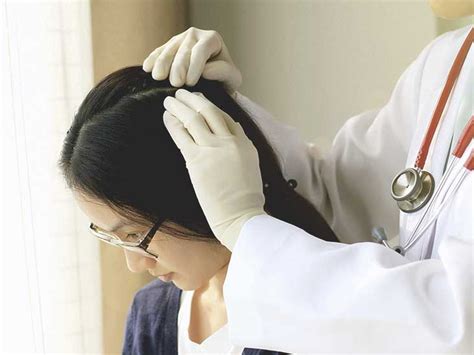 Epidermoid Cyst Scalp