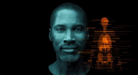 Autocontouring In Radiation Therapy Siemens Healthineers Siemens Healthineers