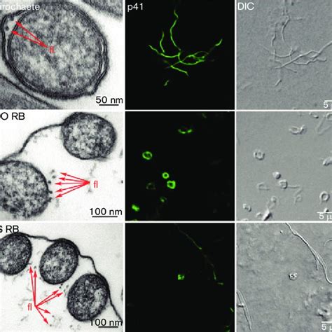 Pdf Morphological And Biochemical Features Of Borrelia Burgdorferi