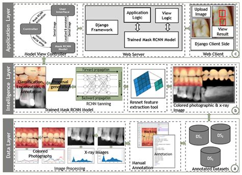 A Hybrid Mask Rcnn Based Tool To Localize Dental Cavities From Real Time Mixed Photographic