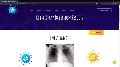 COVID Detection With Chest X Ray Devpost