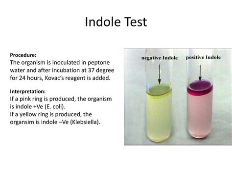 Ppt Biochemical Characterization Of Bacteria Powerpoint Presentation Id1900138