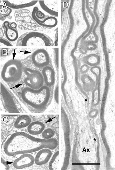 Ultrastructural Analysis Of Mtmr2 Null Sciatic Nerves Ac Transverse