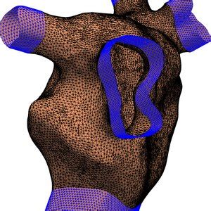 Mesh Extension For Patient 2 Download Scientific Diagram