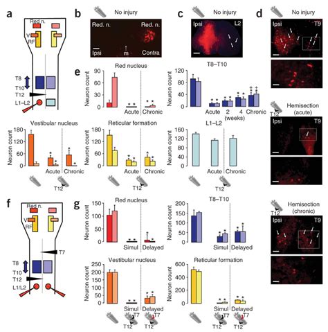 Long Term Loss Of Supraspinal But Not Propriospinal Connections After A Download Scientific
