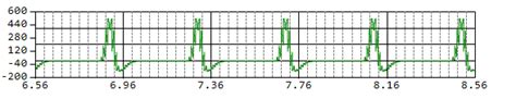 Wpf How To Cure C Winforms Chart Of The Wiggles Stack Overflow