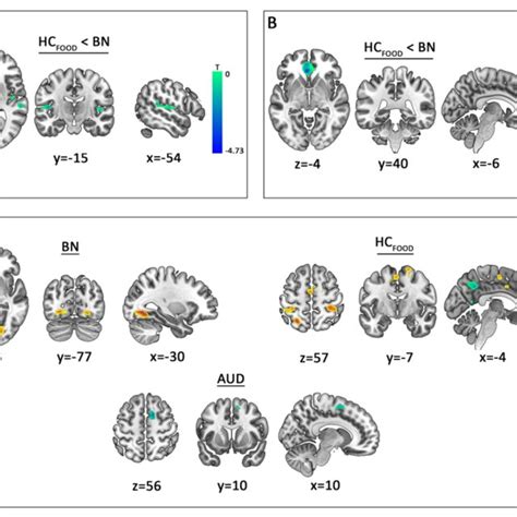 Neural Processing Of Delay Discounting Download Scientific Diagram