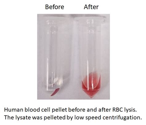 Ack Red Blood Cell Lysis Buffer Recipe Bryont Blog