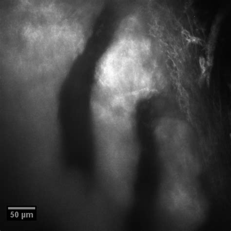 Median Filter Example