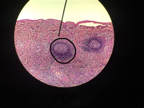 Lymphatic Histology Flashcards Quizlet Lymphatic Histology Flashcards Quizlet