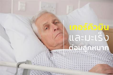 เ เคอร์คิวมินและเซซามินเข้มข้น ต้านอักเสบยับยั้งเซลล์ร้าย Facebook