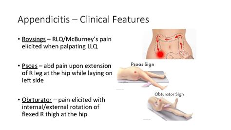 Gi Topics Appendicitis Diverticulitis Obstruction Mesenteric Ischemia