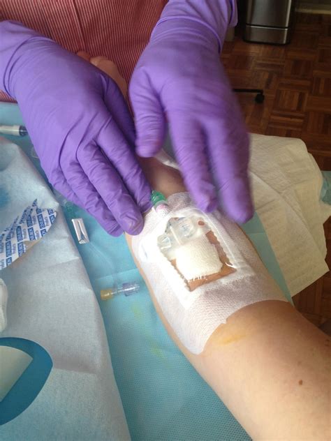 Lyme As I Know It PICC Line Insertion Procedure