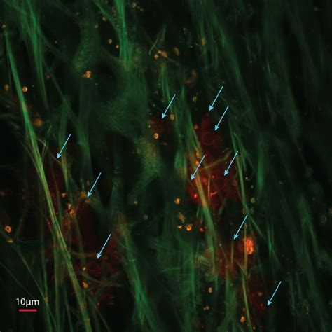 Label Free Imaging Of The Trabecular Meshwork Of A Human Cadaver Eye Download Scientific