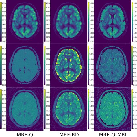 Posterior Distribution Voxel Wise Posterior Mean Posterior Variance Download Scientific