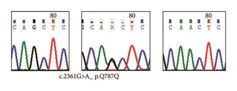 Examples Of Observed Mutations A Exon 19 Deletion B Missense Download Scientific Diagram