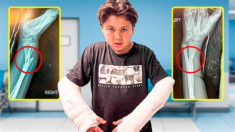 Fundraiser By Ryan Veezy Anthony Veezy Needs Surgery