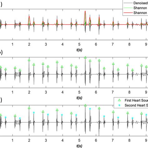The Process Of Peak Detection And Identification Of The Pcg Signal A
