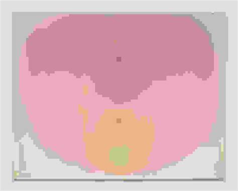 Leon Berkowitz Tantric 1 1981 Available For Sale Artsy