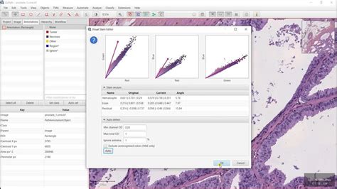 Stain Deconvolution With Qupath Youtube