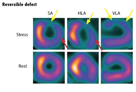 Nucs Core Radiology Self Made Questions Flashcards Quizlet