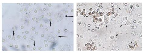 Urinalysis Exam Flashcards Quizlet