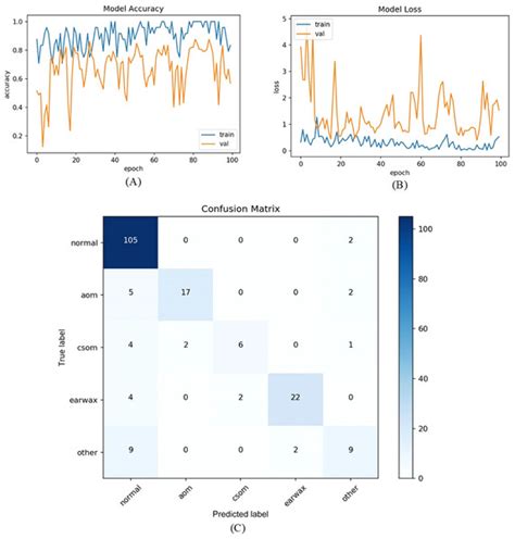 Otitis Media Detection Using Tympanic Membrane Images With A Novel Multi Class Machine Learning