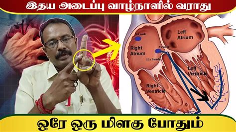 இரதய அடபப வழநளல வரமல தடககம மளக Yogam யகம YouTube