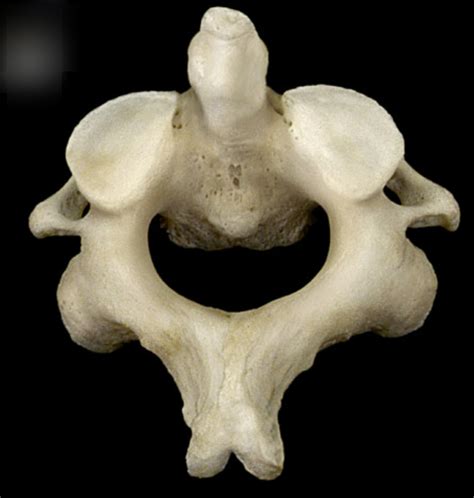 Axis C2 Diagram Quizlet