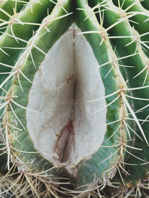 Part Of Cactus Abstract Female Vagina Gynecology And Medicine For