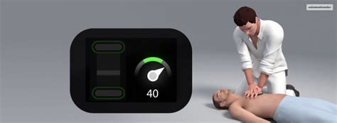 What Does A Chest Compression Feedback Device Monitor Do